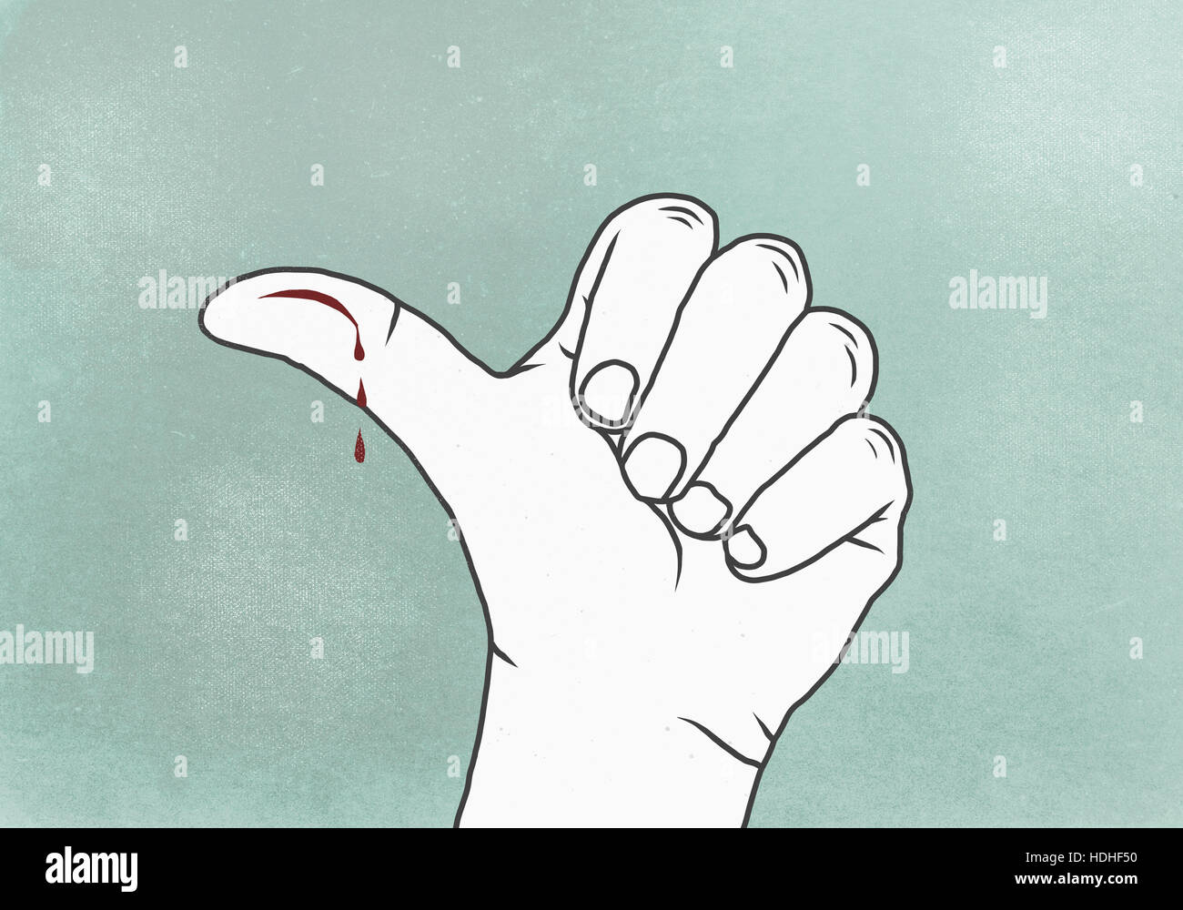 Illustration of bleeding thumb against green background Stock Photo - Alamy