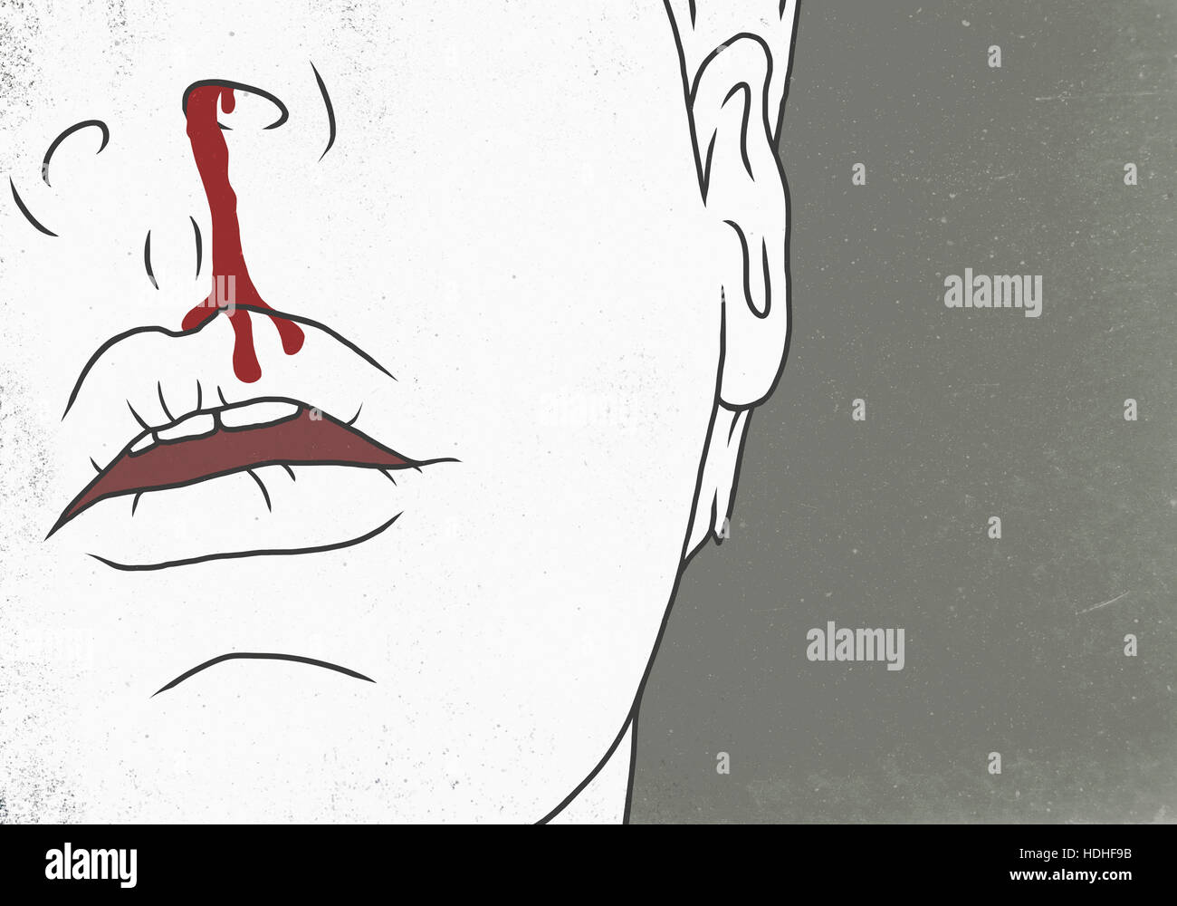 Illustration of man with bleeding nose representing injury Stock Photo ...