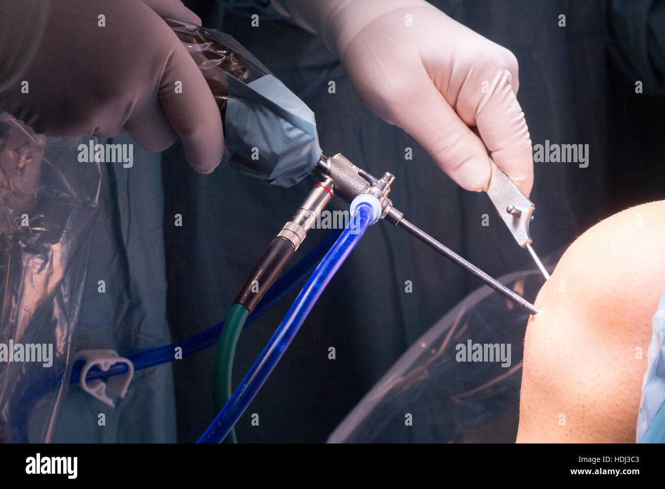 Surgical operation for knee arthroscopy micro surgery in hospital ...