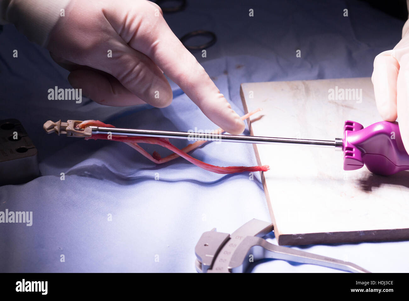 Knee tendon and ligament repair surgery in hospital operating theater ...