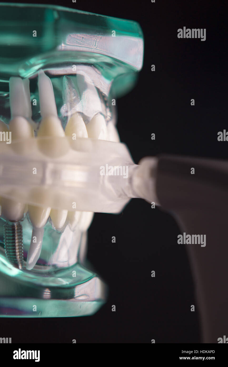 Vibrating dental device with invisible orthodontics Stock Photo - Alamy