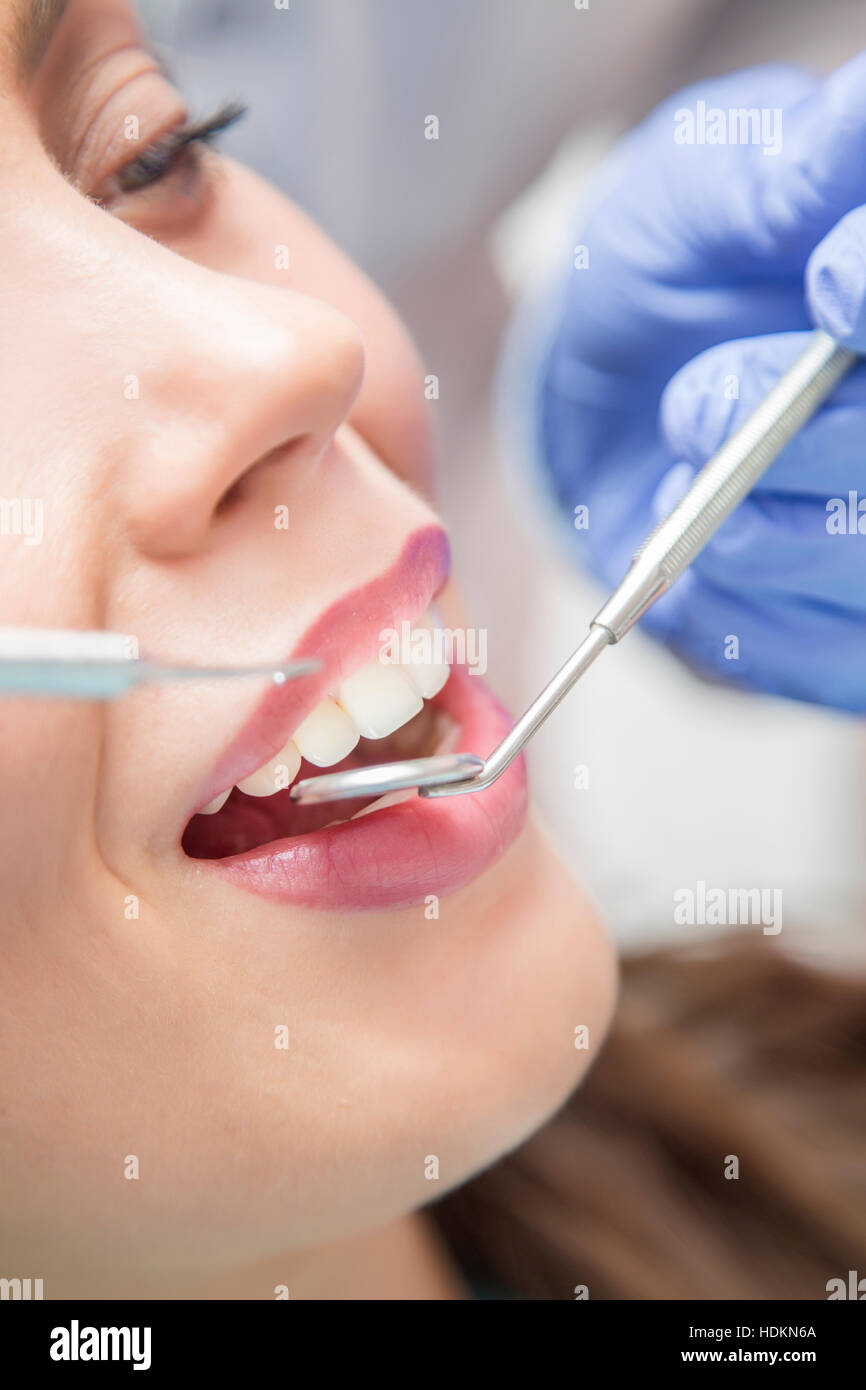 Close up view of open mouth during oral checkup at the dentist Stock ...