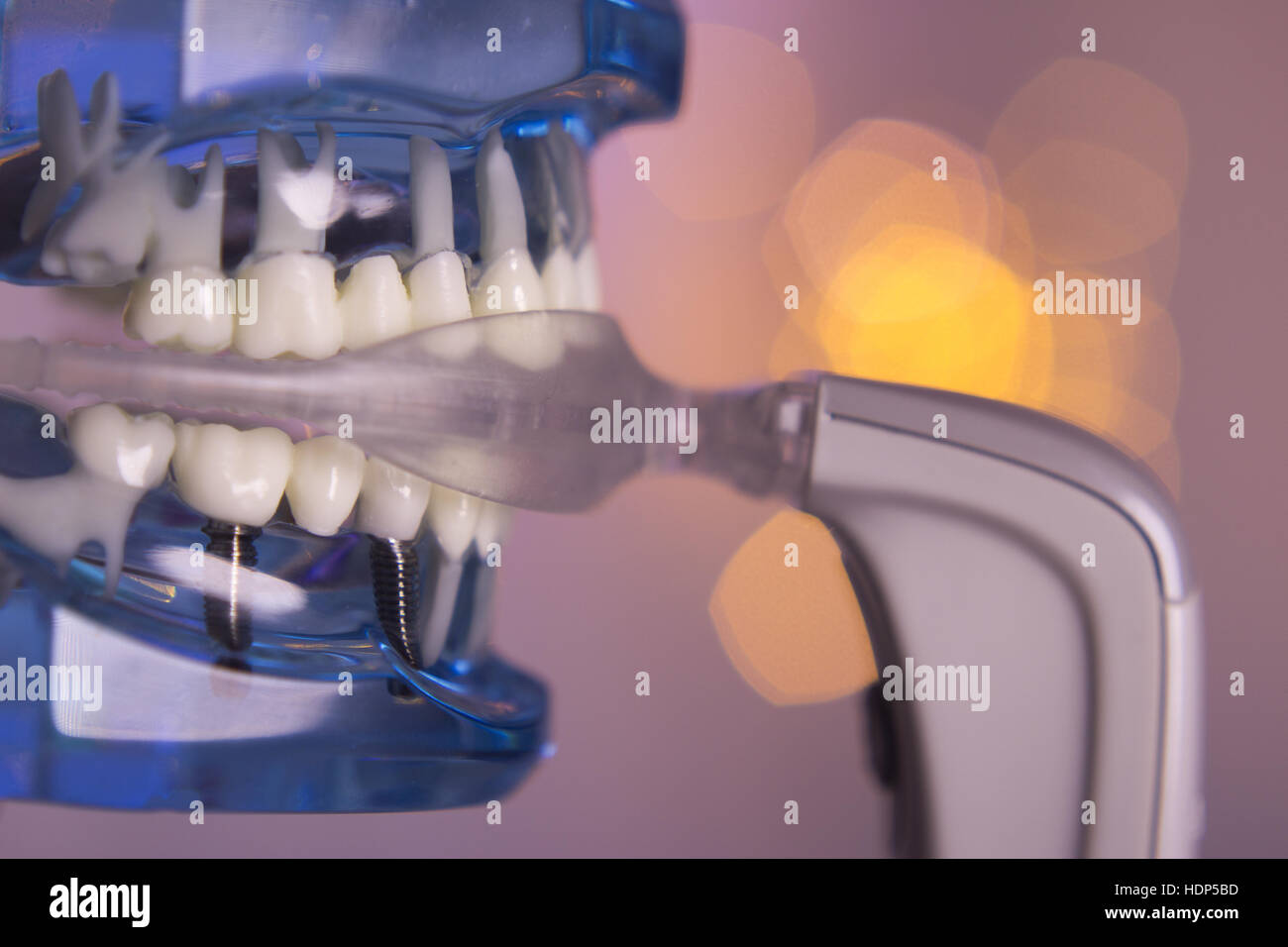 Vibrating dental device with invisible orthodontics Stock Photo - Alamy