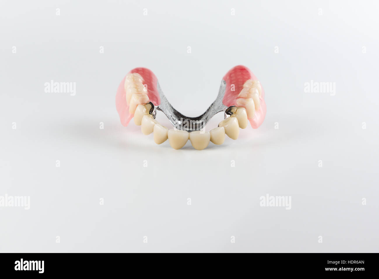 Clasp prosthesis with and attachments fixing ceramic crowns Stock Photo ...