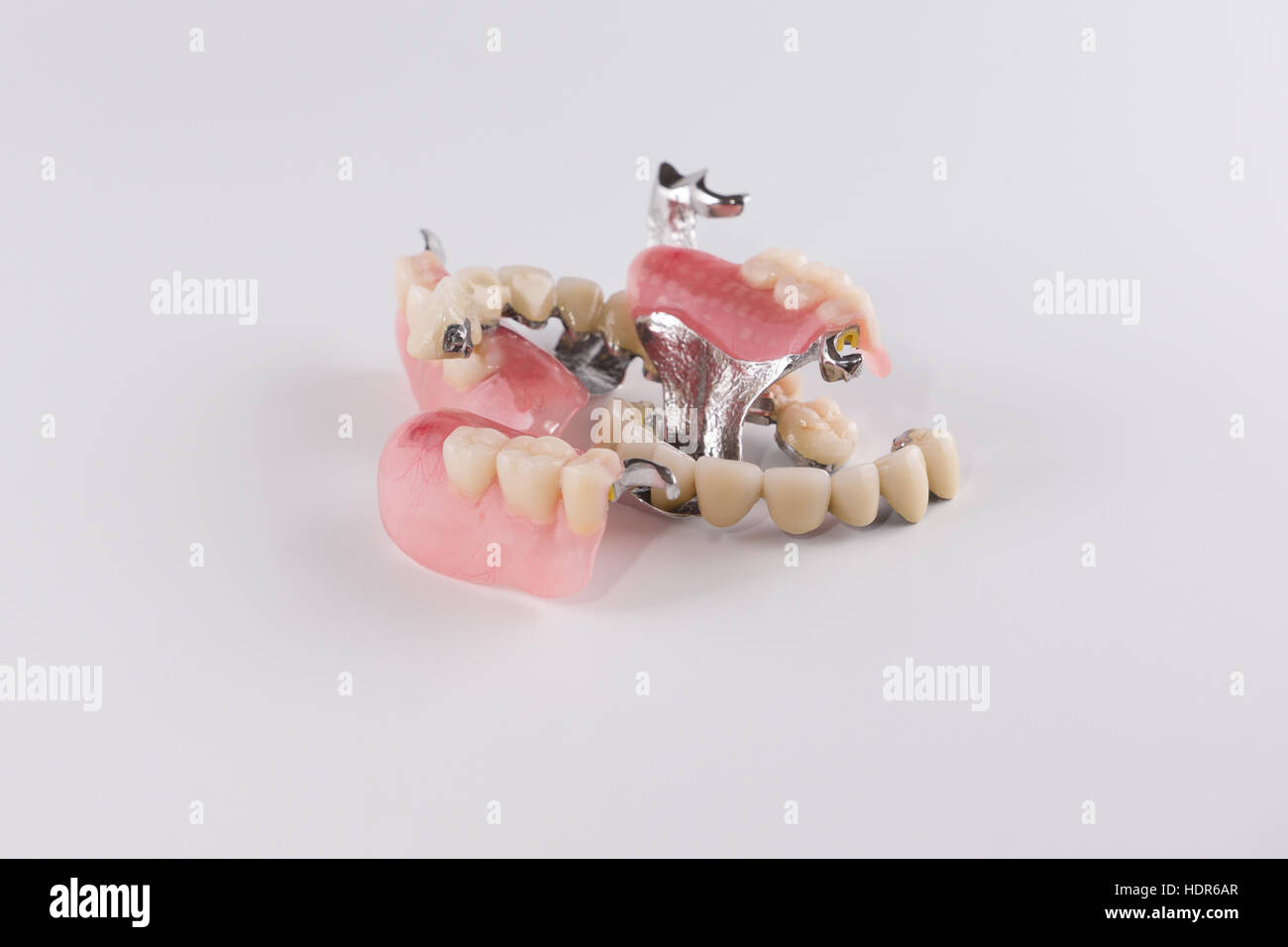 Clasp prosthesis with and attachments fixing ceramic crowns Stock Photo ...