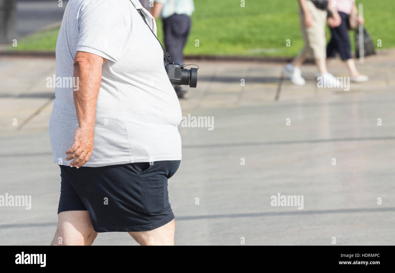 Obese the hi-res stock photography and images - Alamy