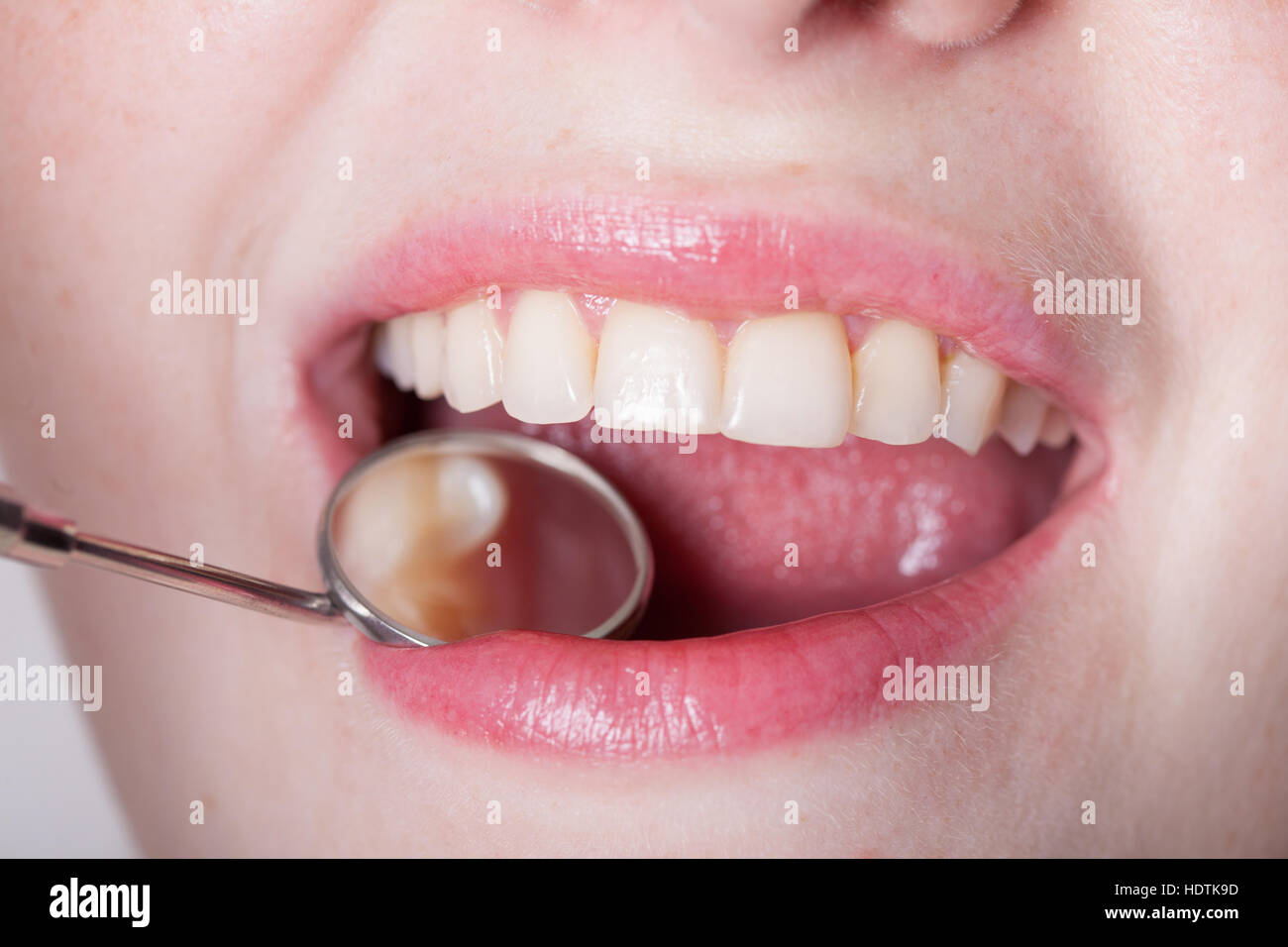 Check the teeth Stock Photo - Alamy
