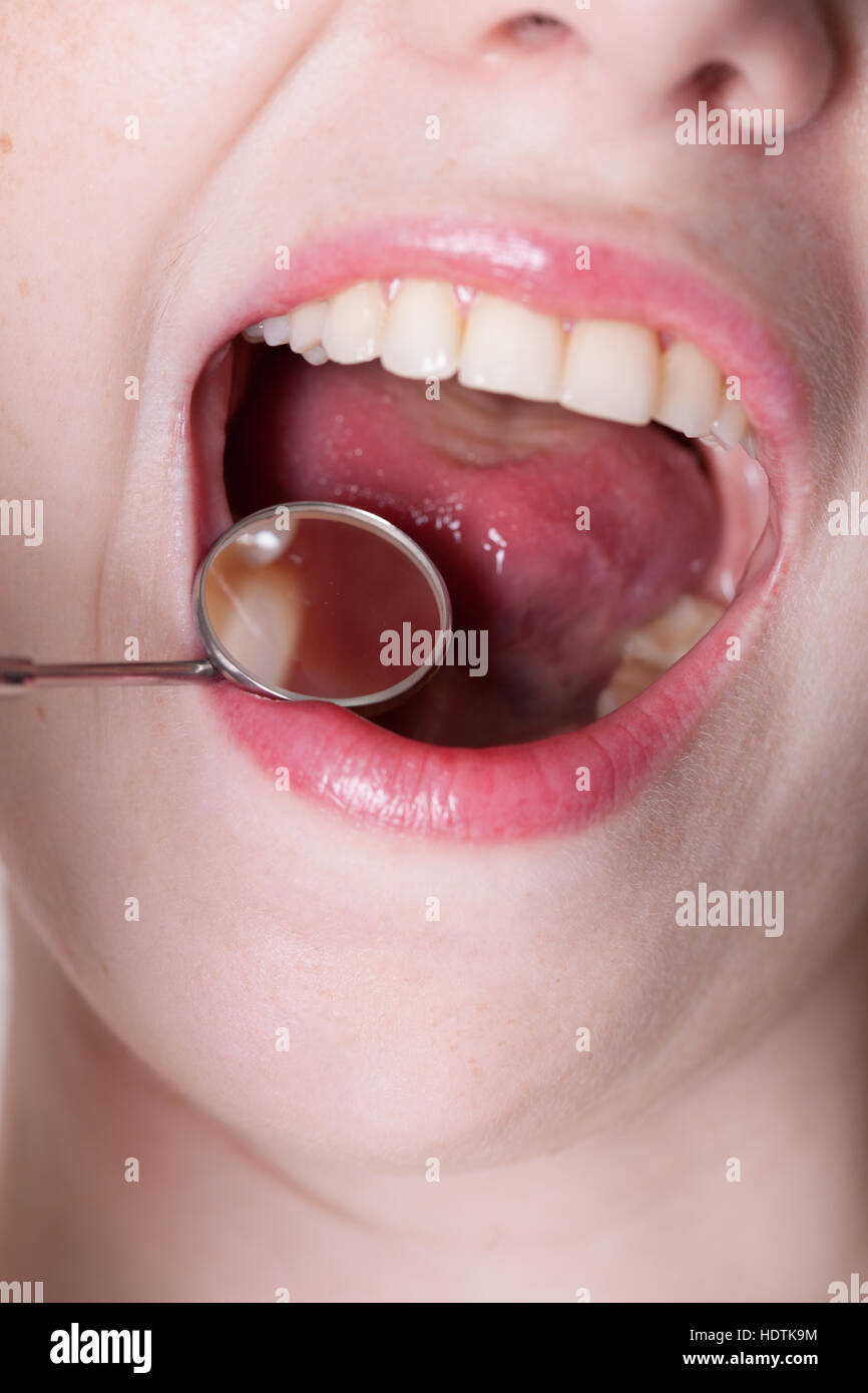 Check the teeth Stock Photo - Alamy