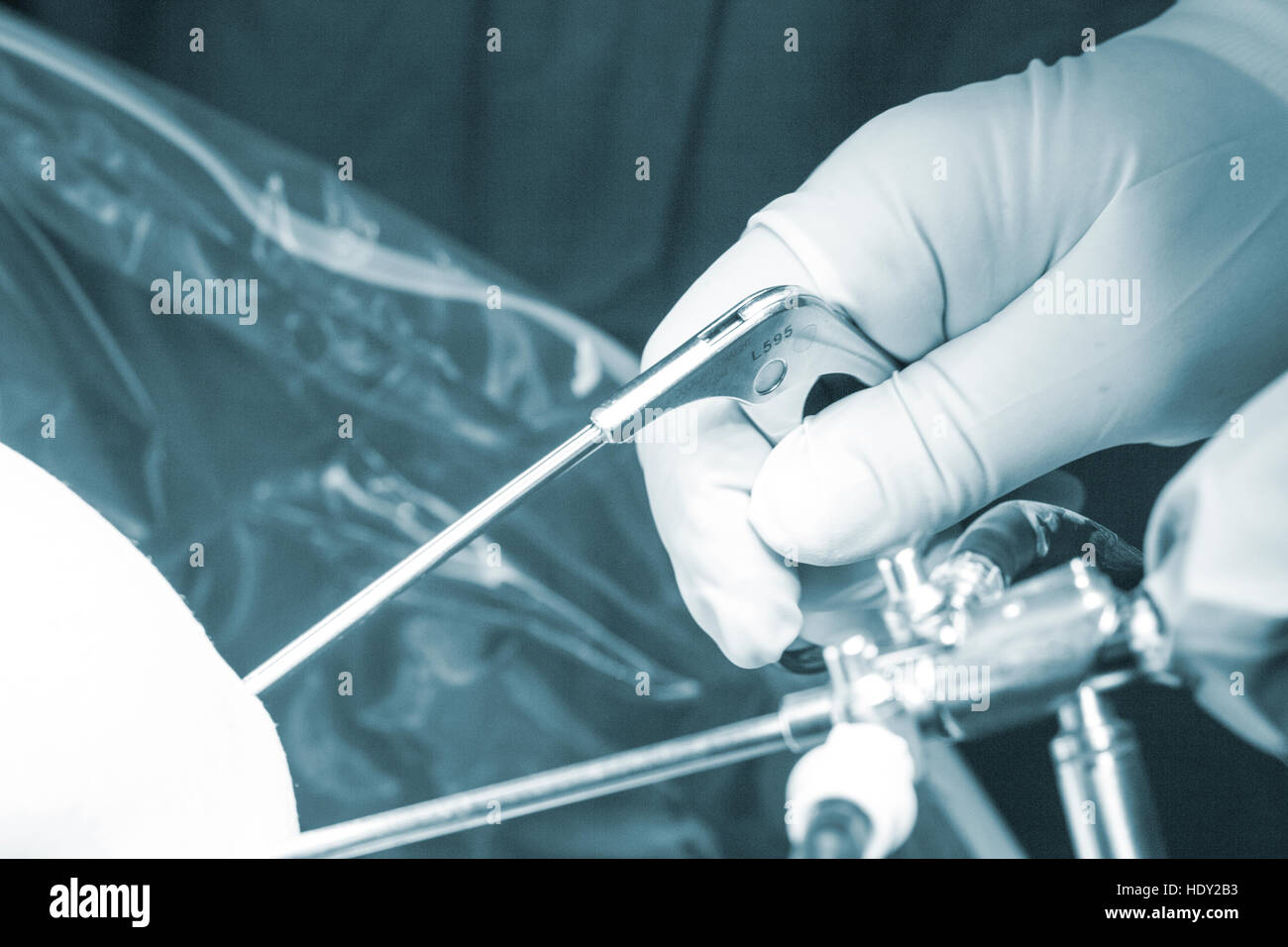 Surgical operation for knee arthroscopy micro surgery in hospital ...