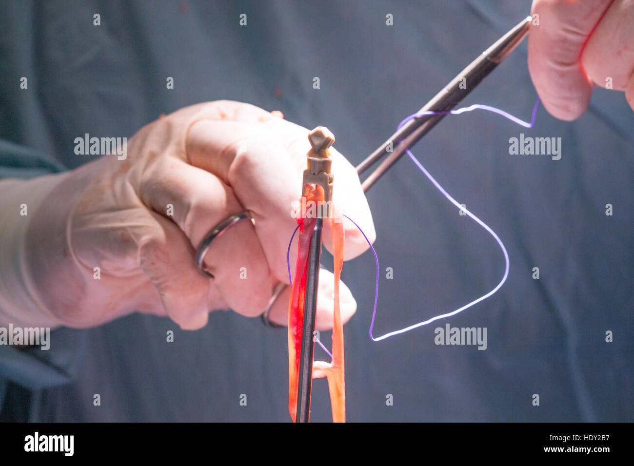 Knee tendon and ligament repair surgery in hospital operating theater ...