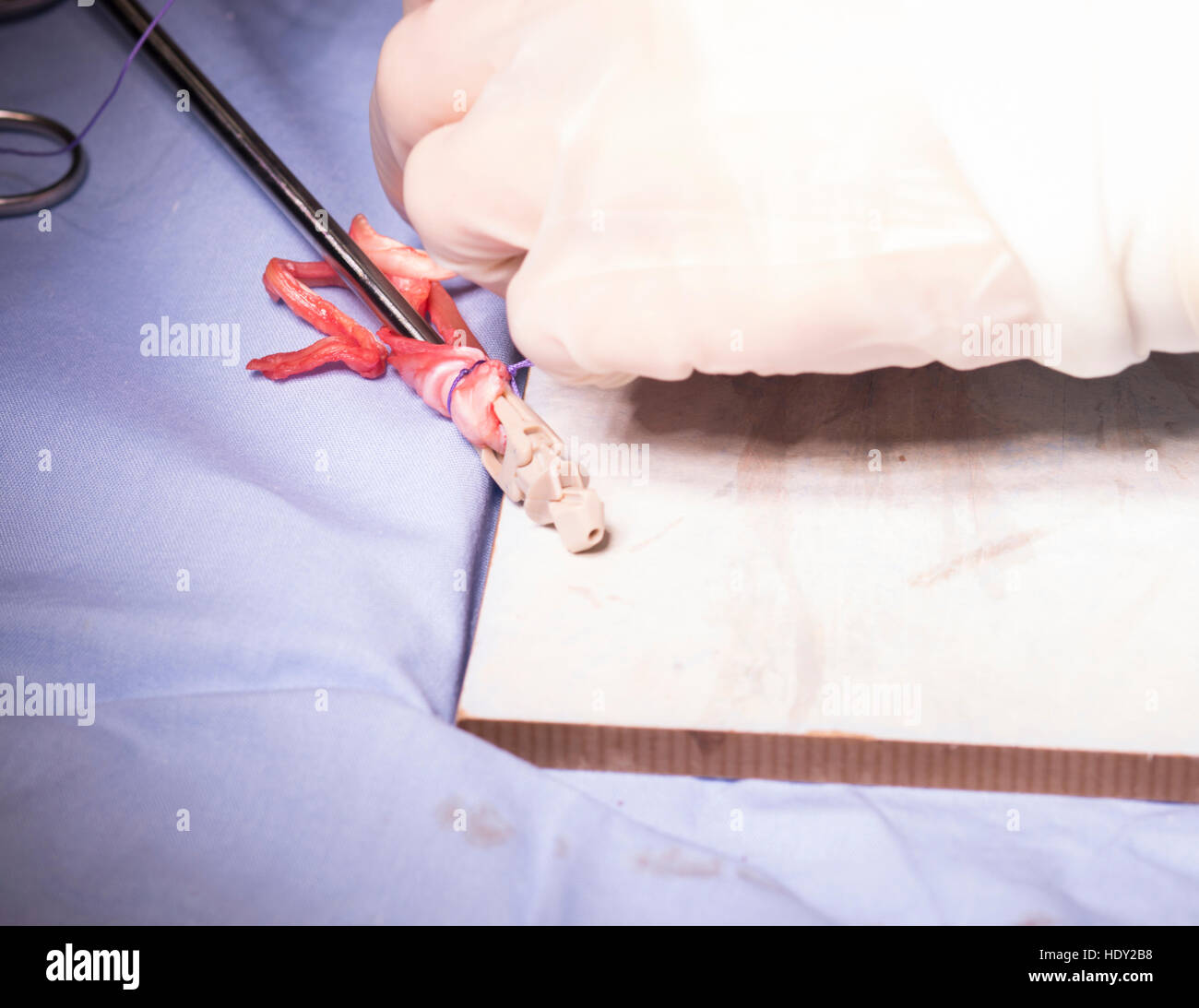 Knee tendon and ligament repair surgery in hospital operating theater ...