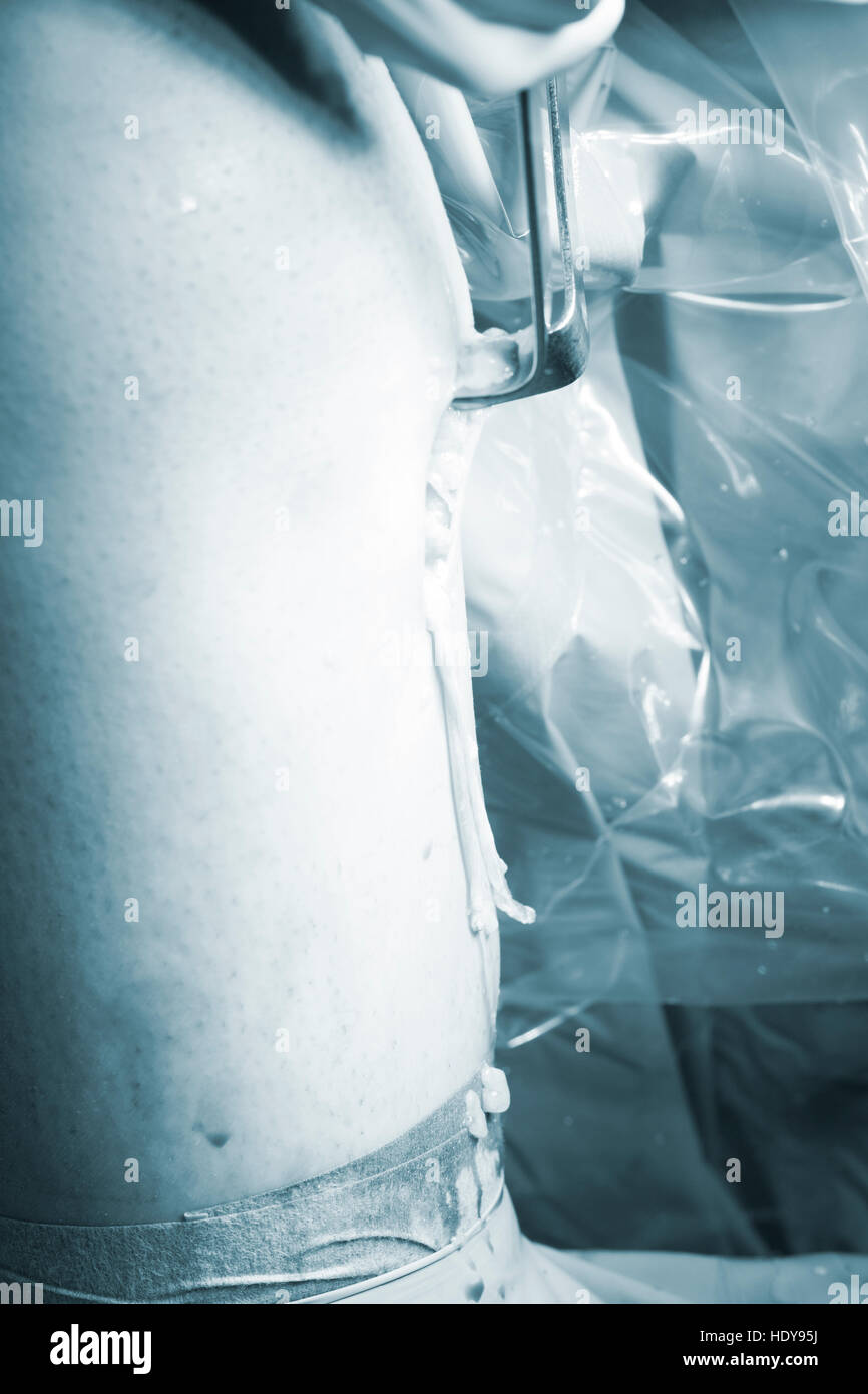 Surgical operation knee arthroscopy micro surgery on knee, tendon ...