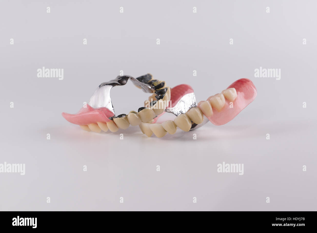 Clasp prosthesis with and attachments fixing ceramic crowns Stock Photo ...