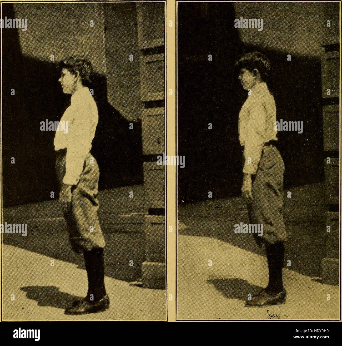 *The Posture of School Children* (1913) addresses the importance of ...