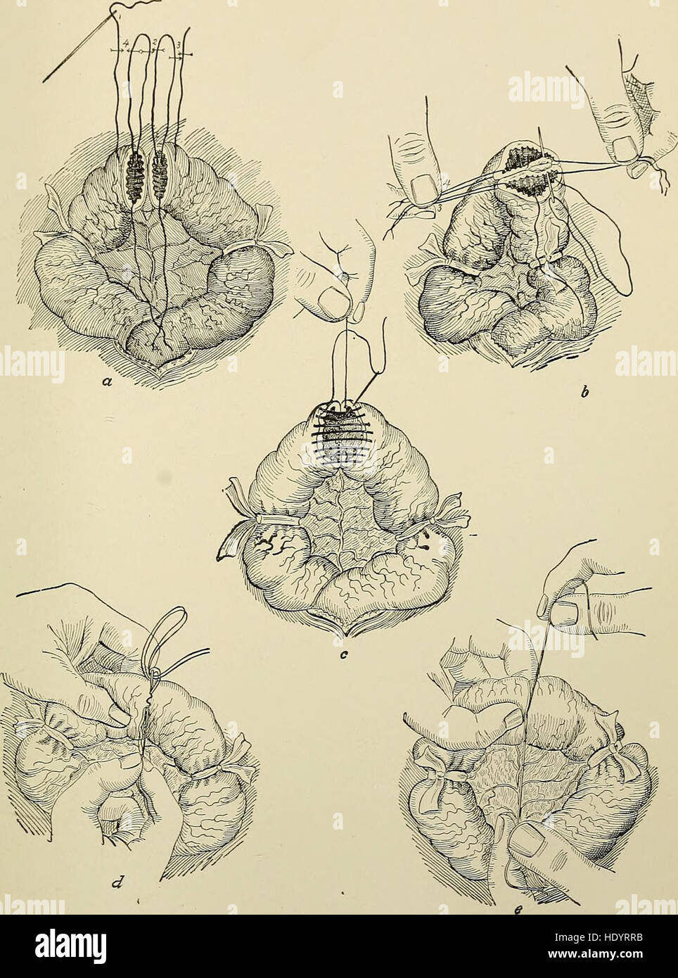 'Modern Surgery, General and Operative' (1919) discusses advancements ...