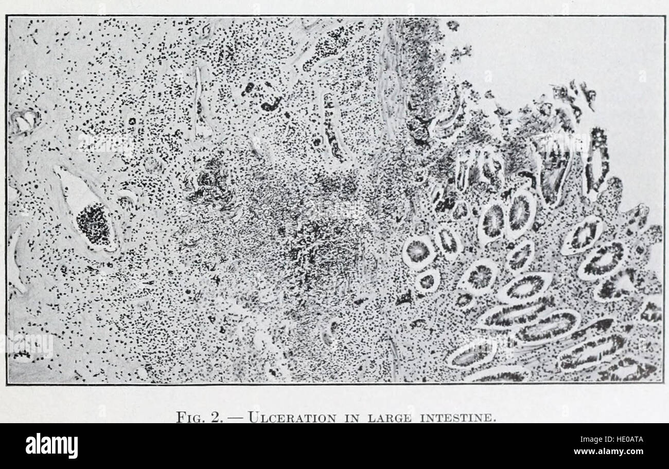 A 1915 report documenting the first expedition to South America, led by ...