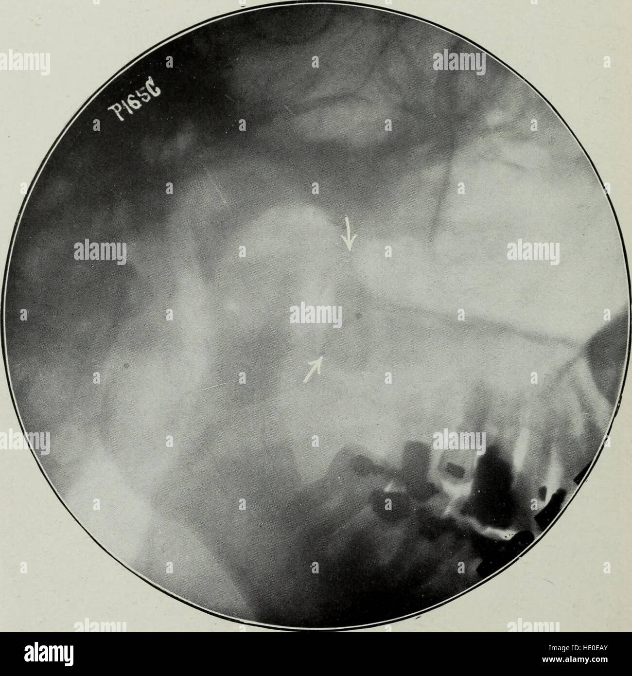 'Elementary and Dental Radiography' (1813) introduces the early methods ...