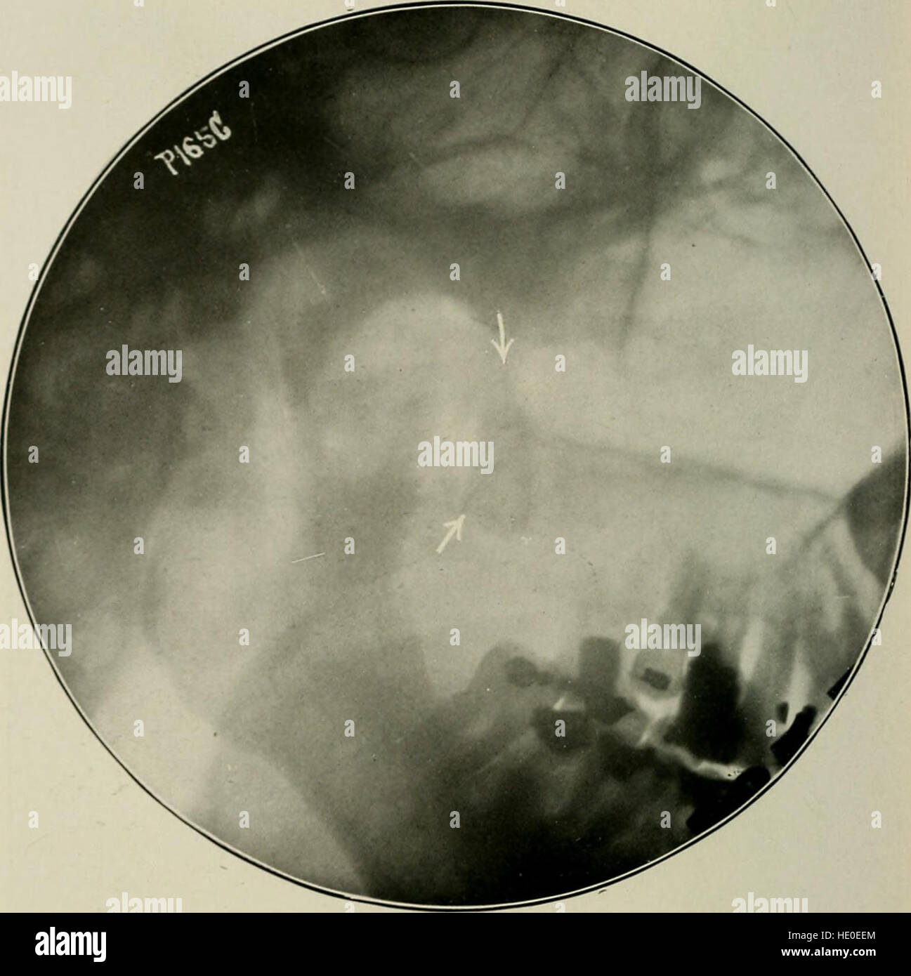 *Elementary and Dental Radiography* (1913) provides foundational ...