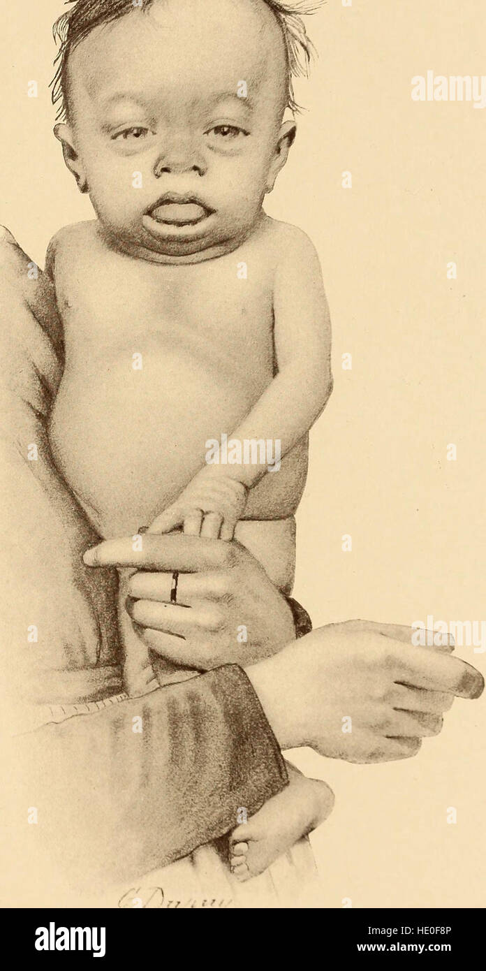 This 1910 publication provides an in-depth study of common diseases ...