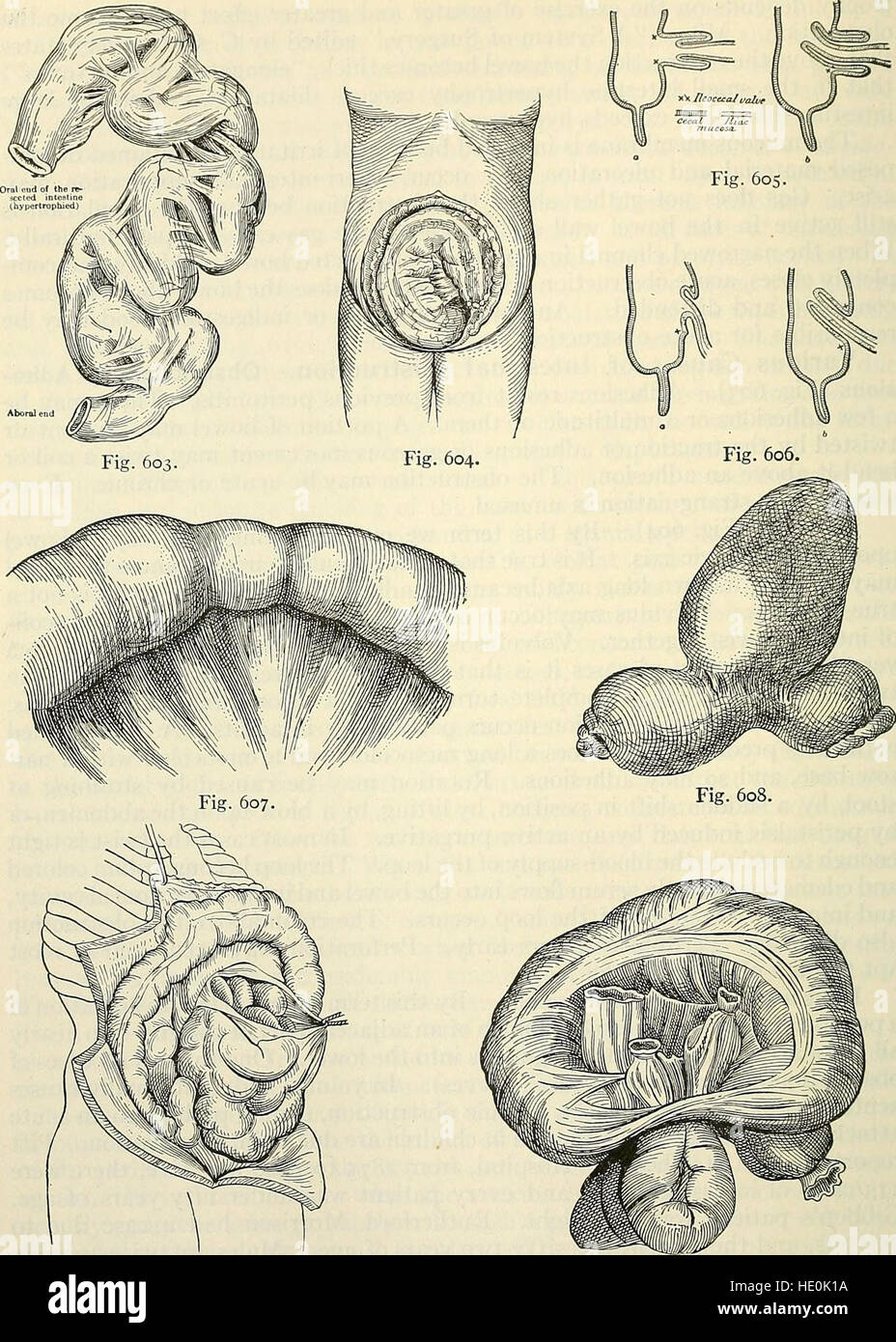A comprehensive guide to modern surgery published in 1914, focusing on ...