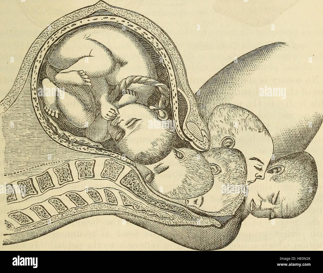This 1875 medical work on midwifery covers the practice and techniques ...