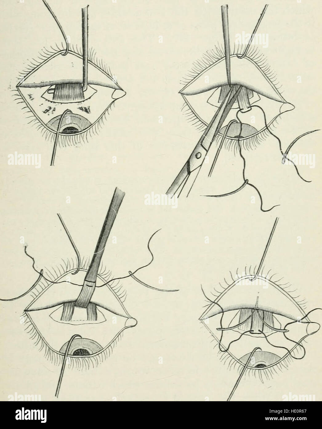 This 1905 work provides an atlas and comprehensive overview of surgical ...