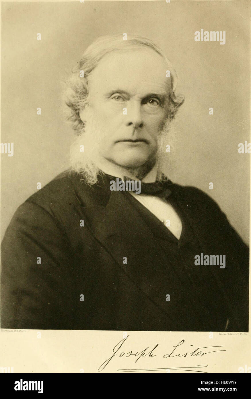 A collection of scientific papers by Joseph Lister, the pioneering ...