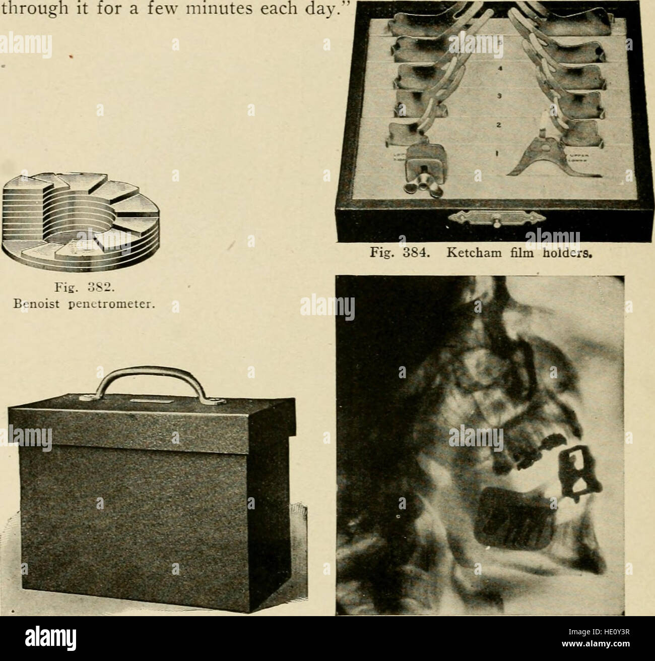 Elementary and dental radiography by howard riley raper 1918 hi-res ...