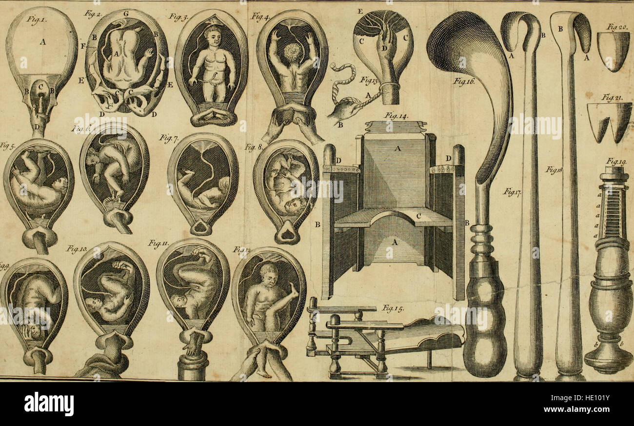 'A General System of Surgery in Three Parts' outlines surgical ...
