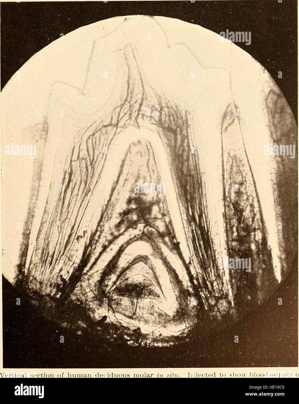 'Principles and Practice of Operative Dentistry' (1901) provides a ...