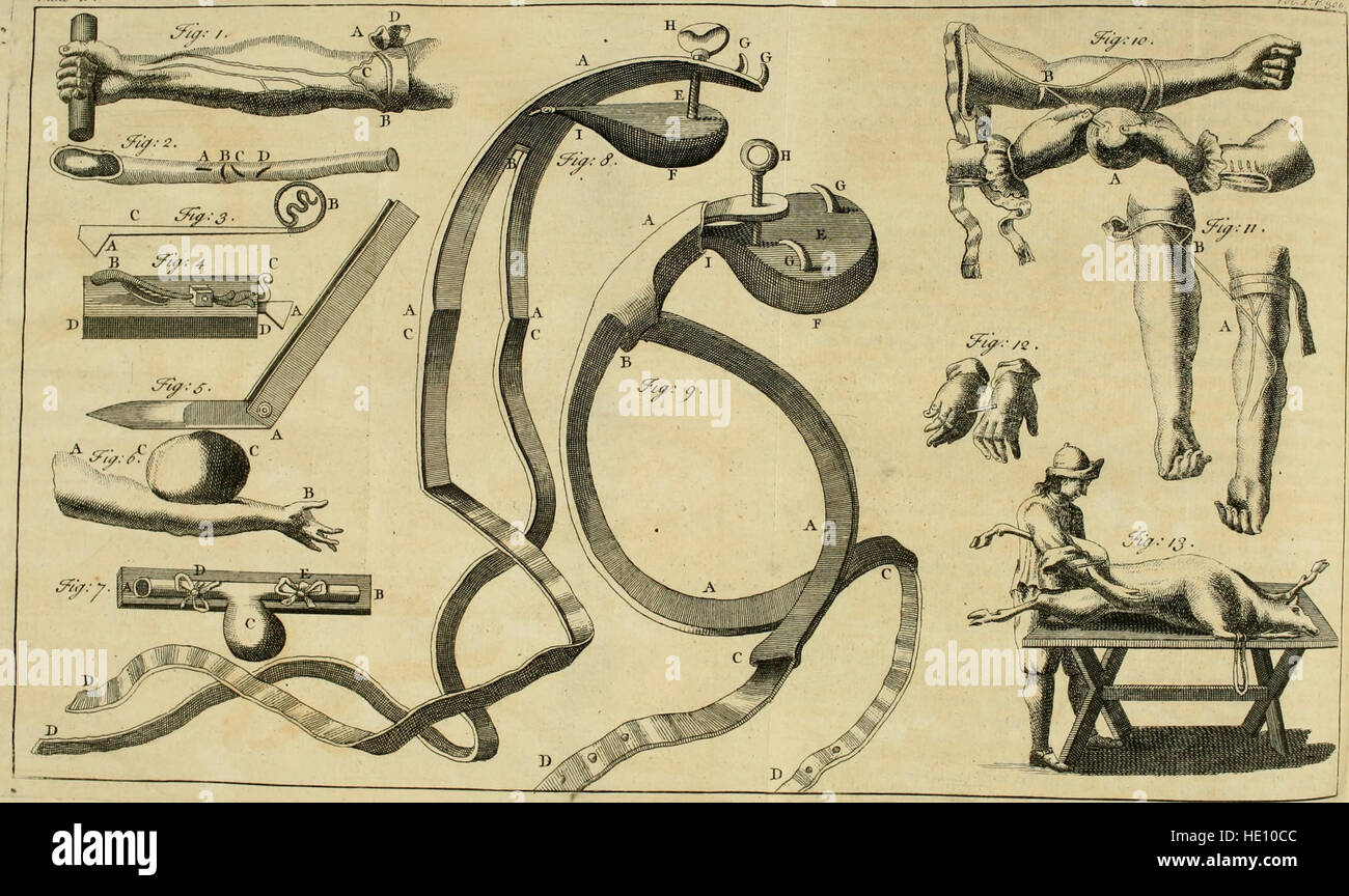 This medical text outlines surgical practices, detailing the management ...