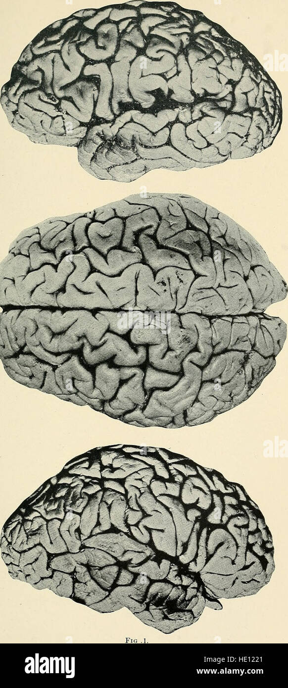 The 1920 Bulletin of the Massachusetts Department of Mental Diseases ...