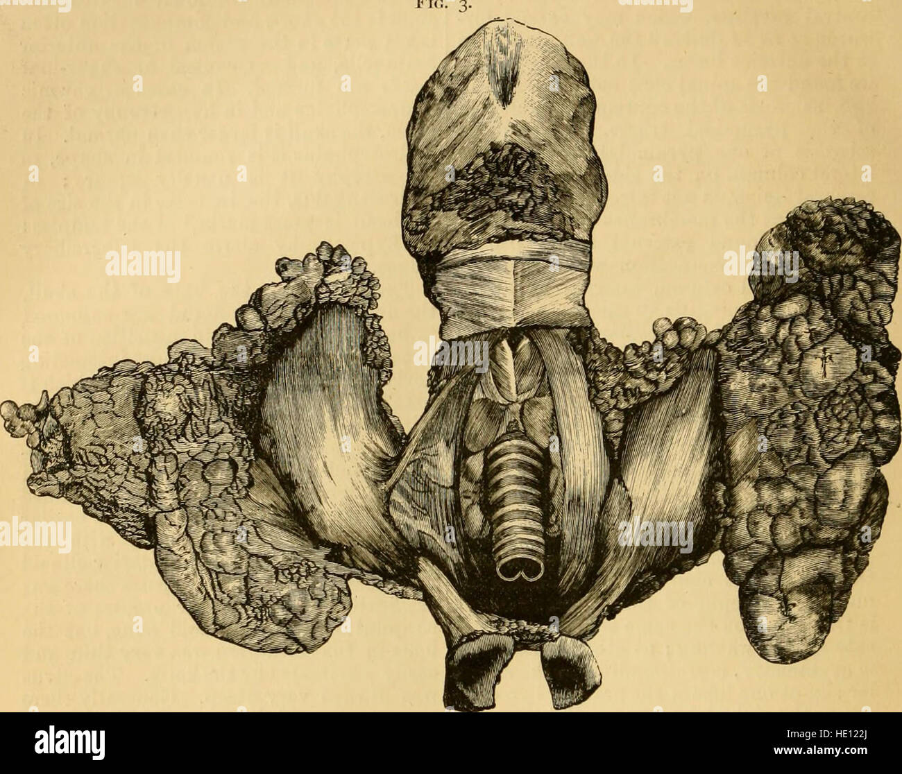 Mental illness terminology hi-res stock photography and images - Alamy