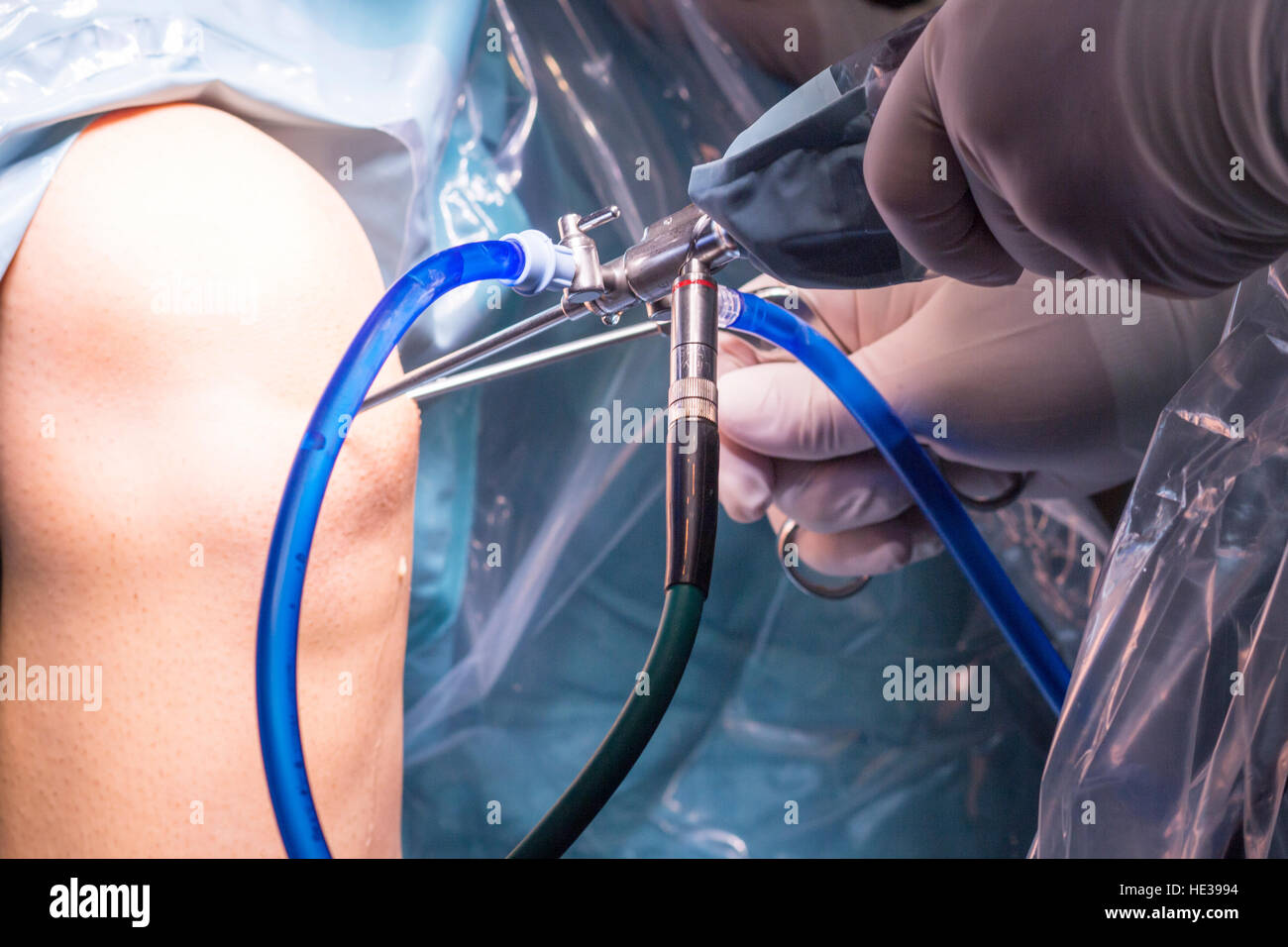Surgical operation for knee arthroscopy micro surgery in hospital ...