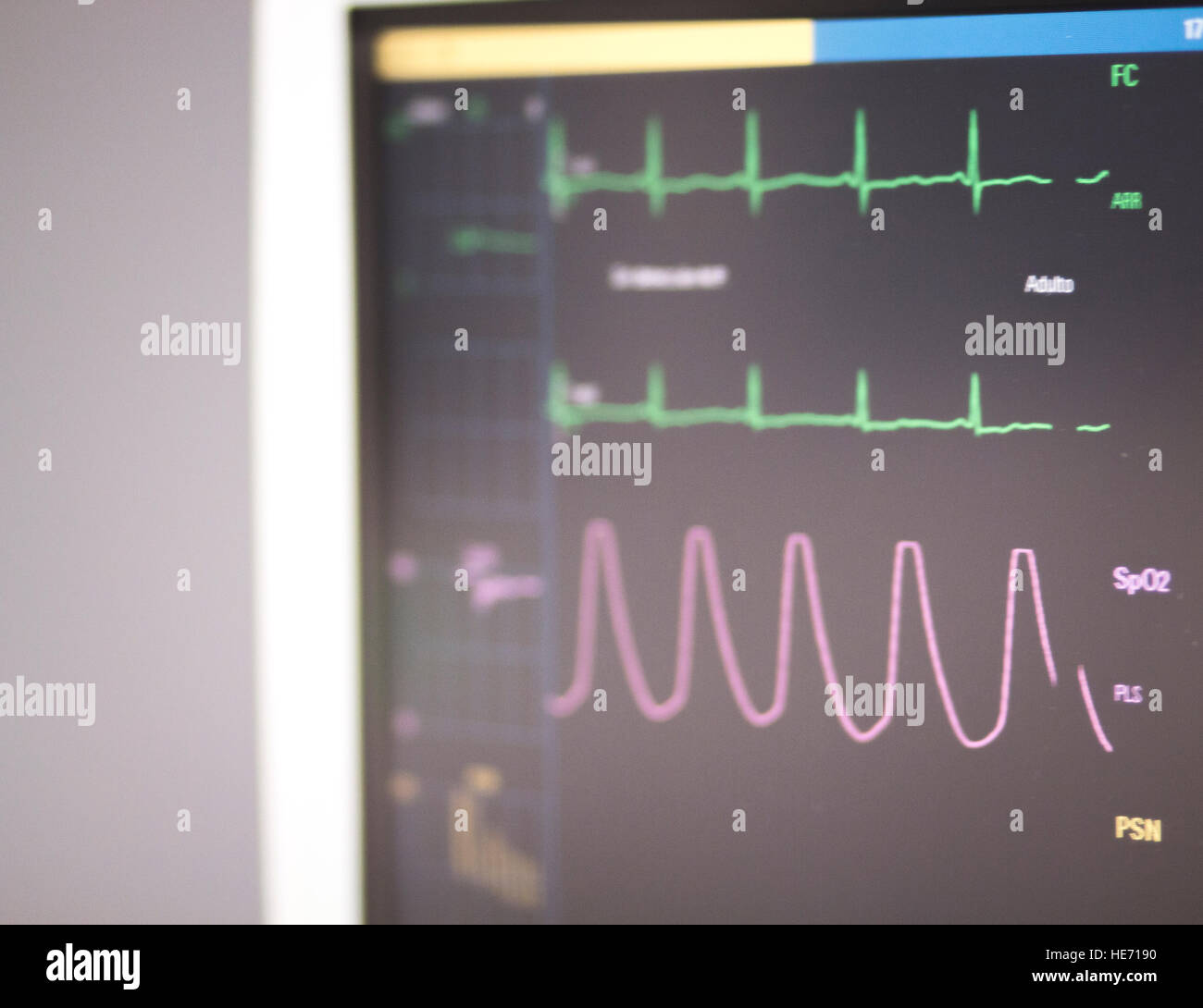 Electrocardiograph in hospital surgery operating theater emergency room ...
