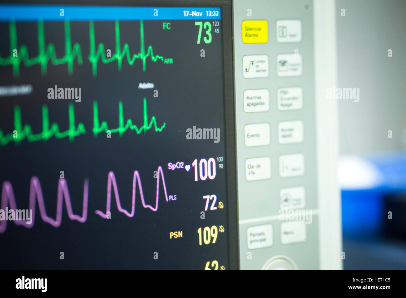 Electrocardiogram in hospital surgery operating theater emergency room ...