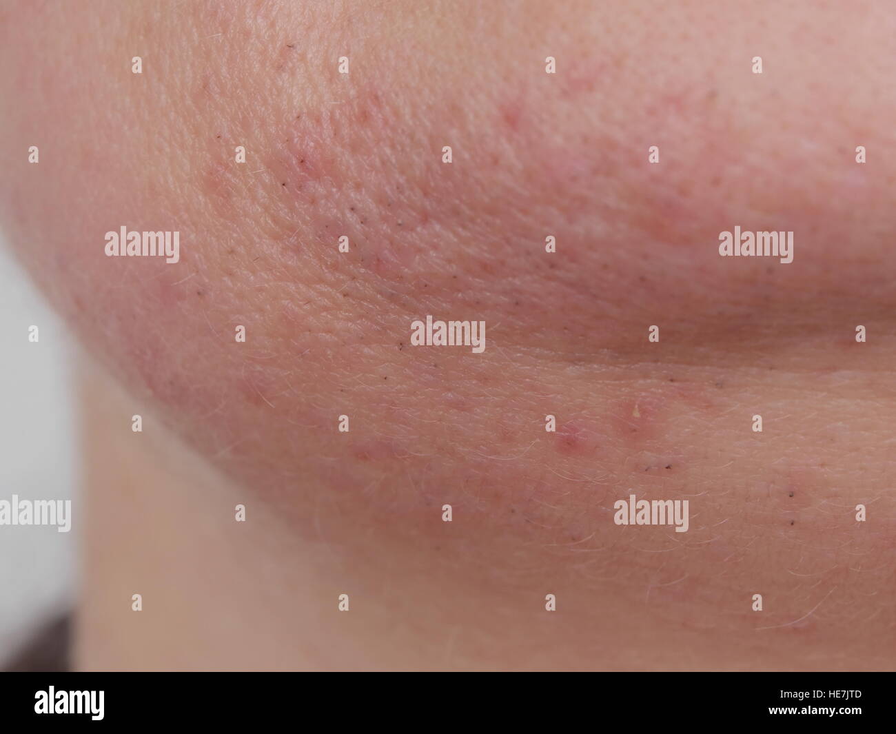 Close up veins blood hi-res stock photography and images - Alamy