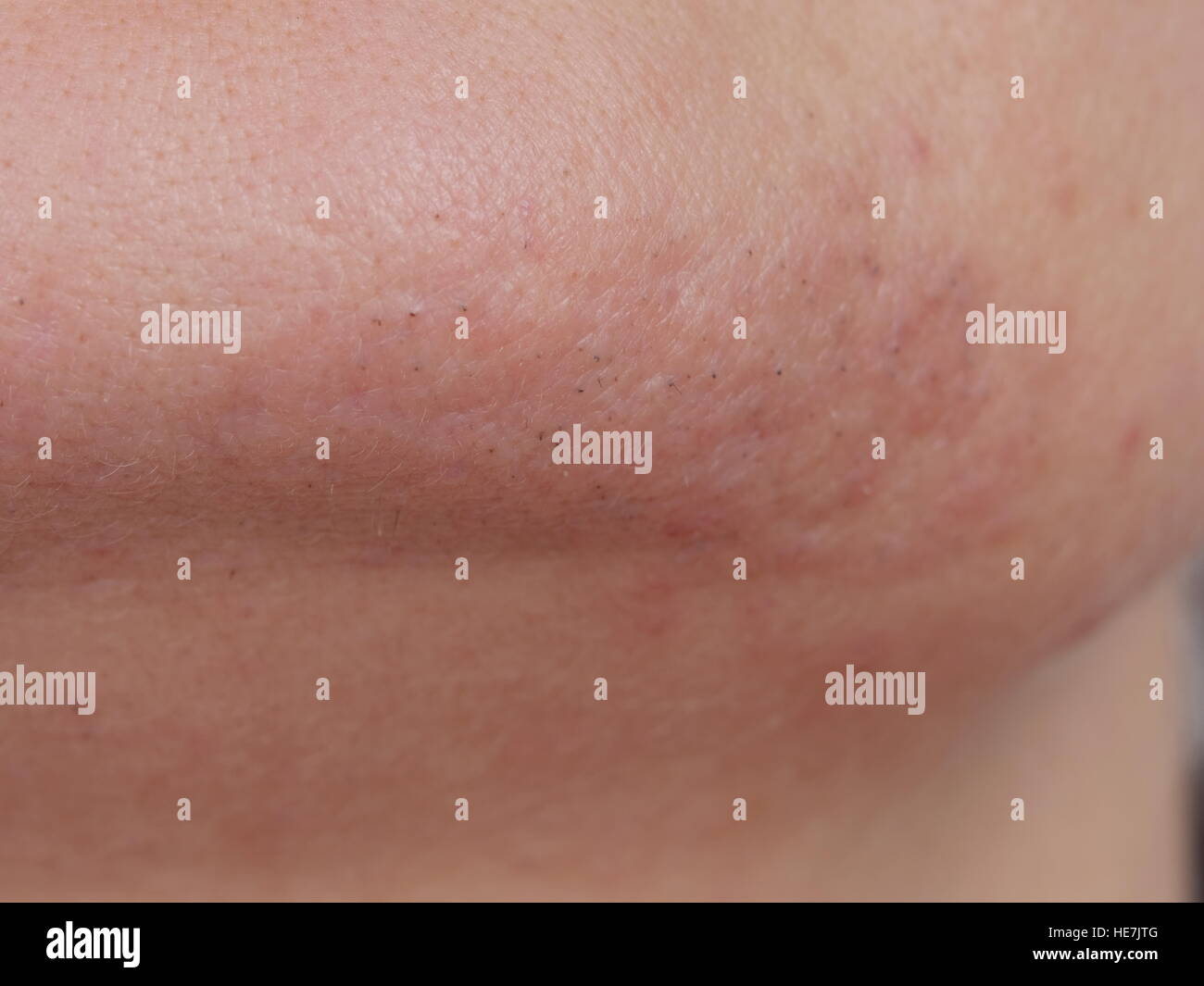 Close up veins blood hi-res stock photography and images - Alamy