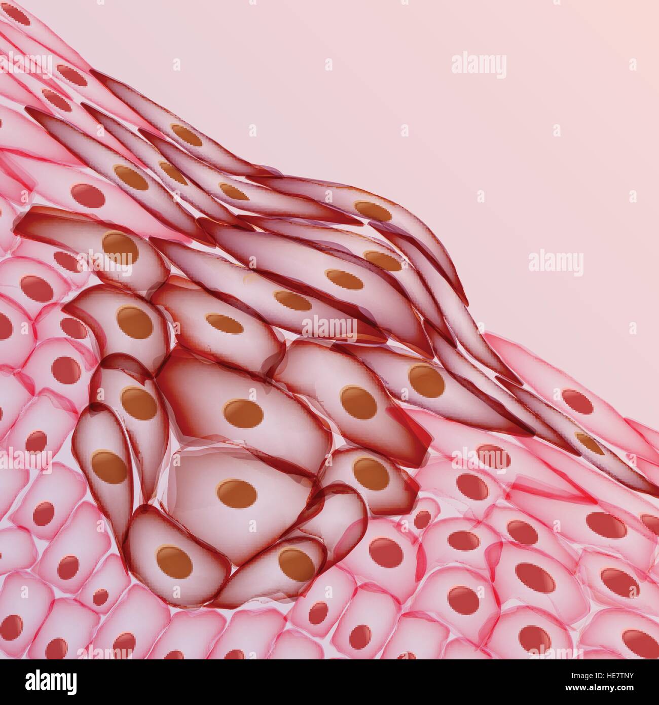 Growing Tumor, Tissue Section - Vector Illustration Stock Vector Image ...