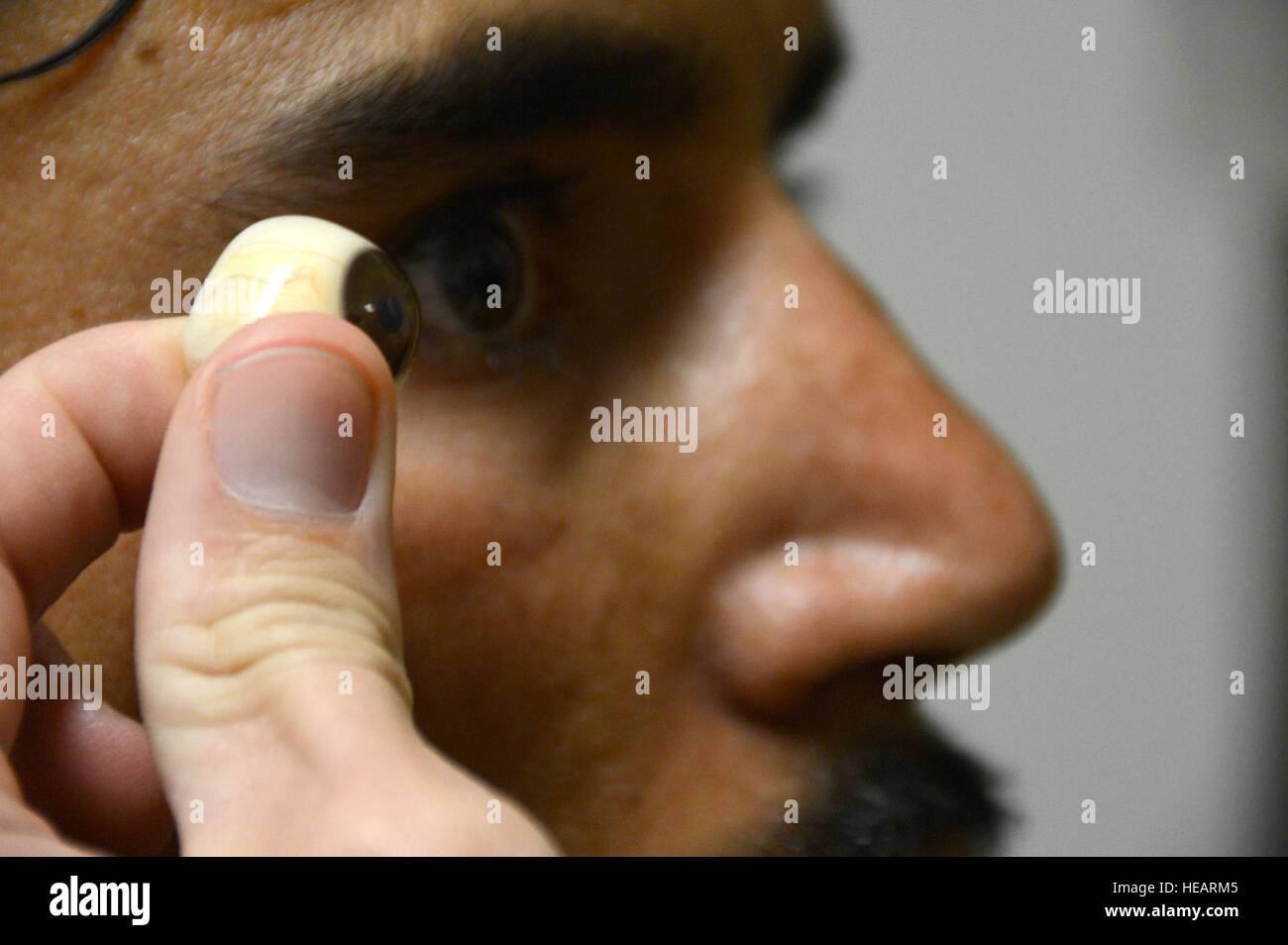 Empty Eye Socket Medical