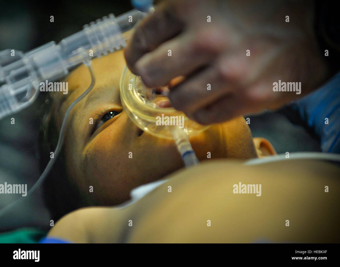 Hamed, a five year-old Afghan boy is prepped for surgery by members of ...