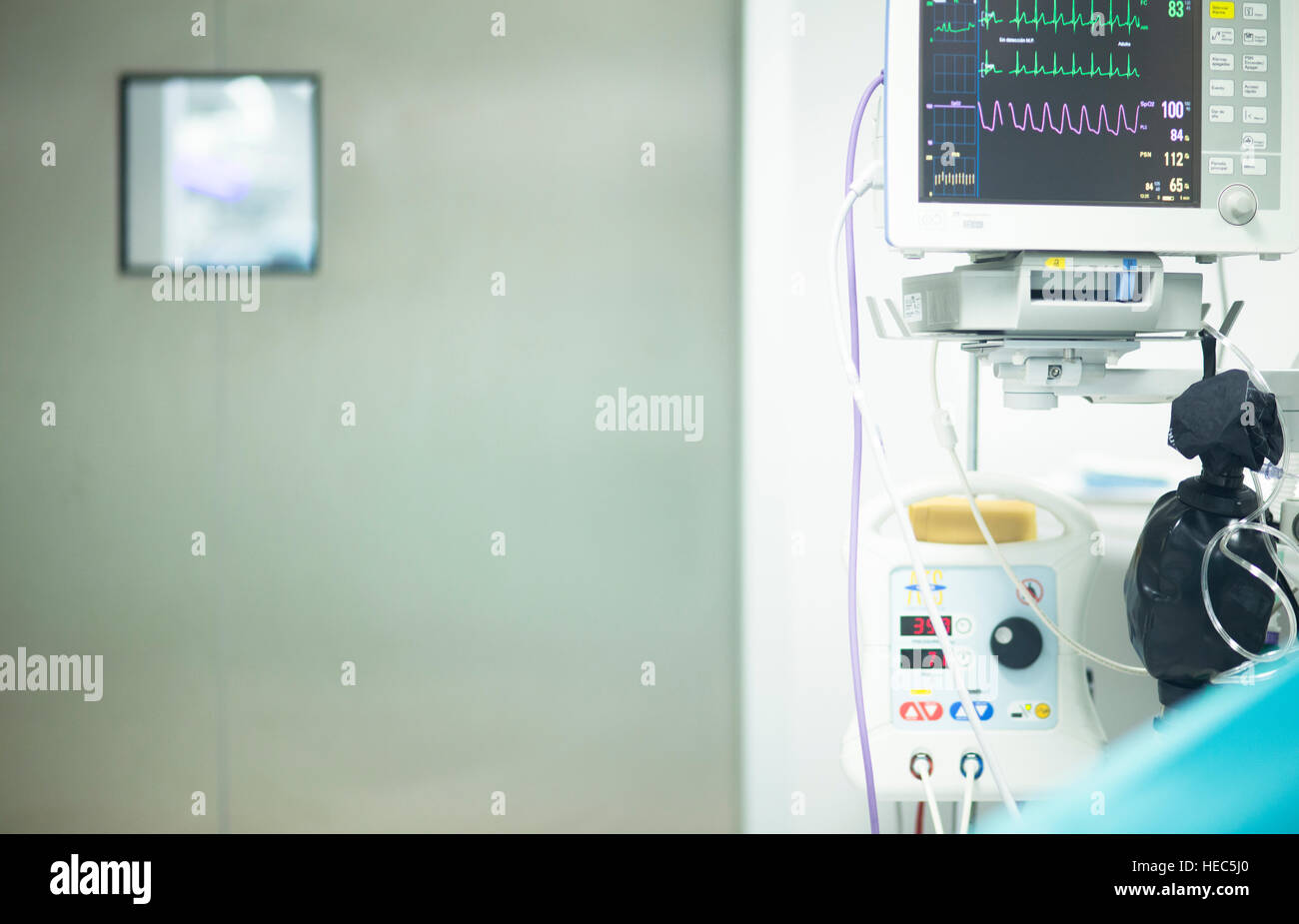 Electrocardiogram in hospital surgery operating theater emergency room ...