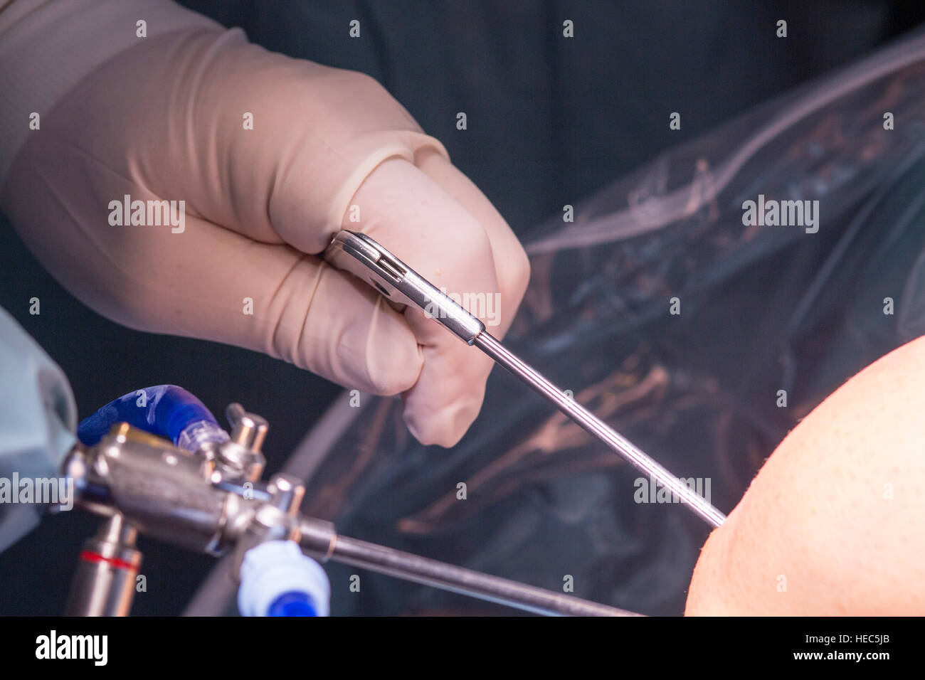 Surgical operation for knee arthroscopy micro surgery in hospital ...