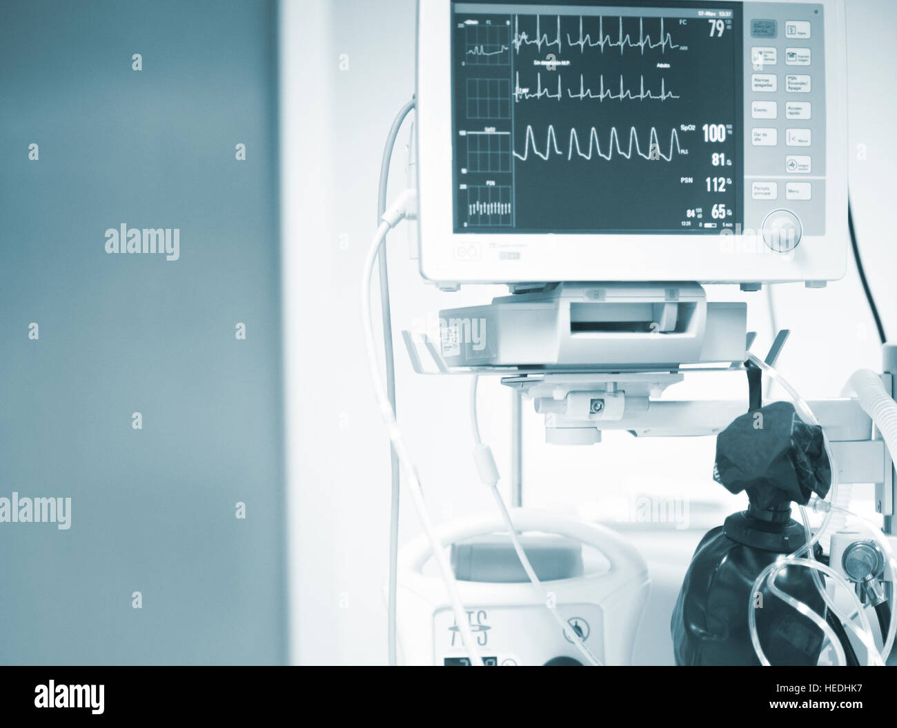 Electrocardiogram in hospital surgery operating theater emergency room ...