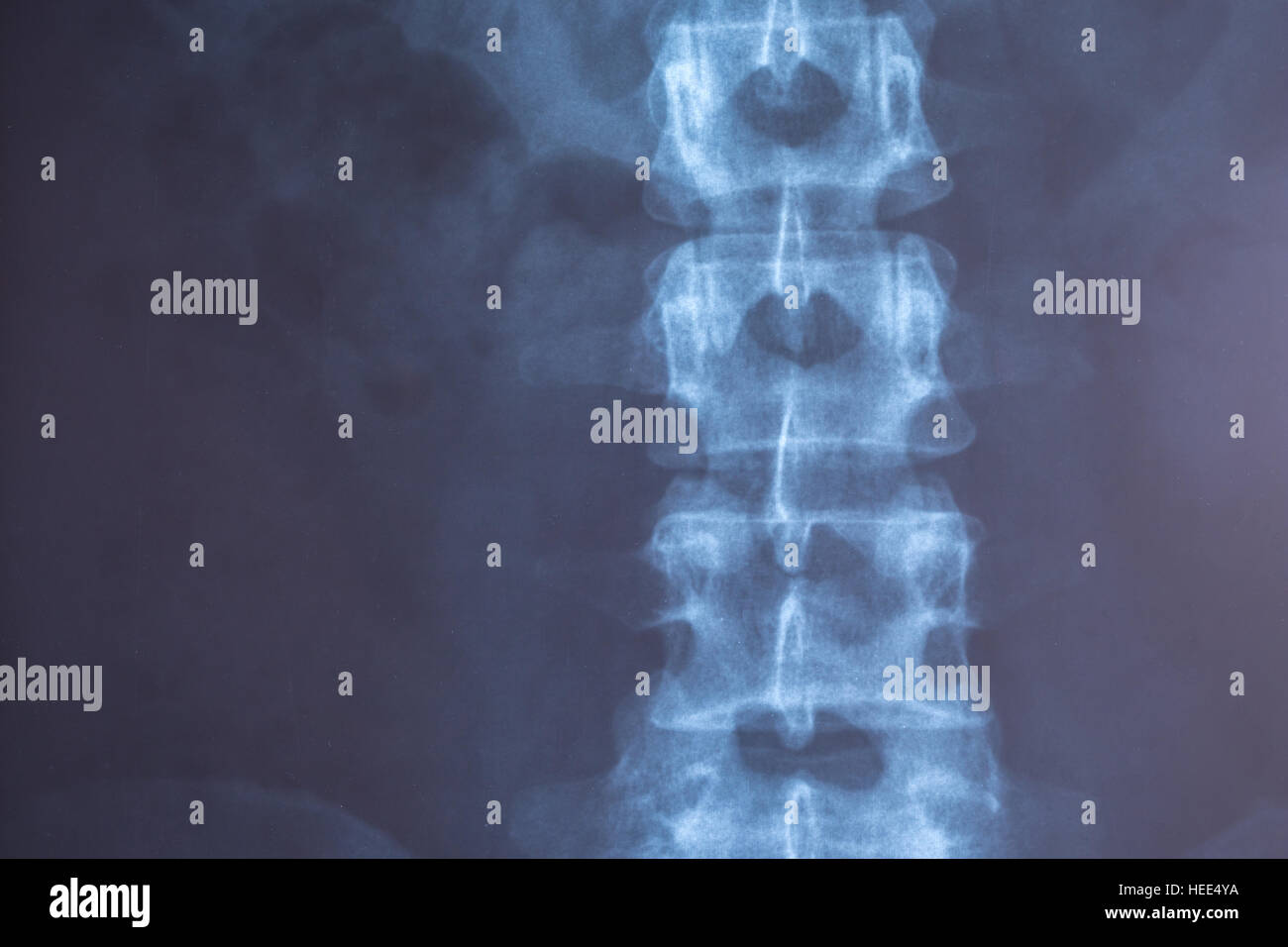 Close up X-Ray image of human for a medical diagnosis Stock Photo - Alamy