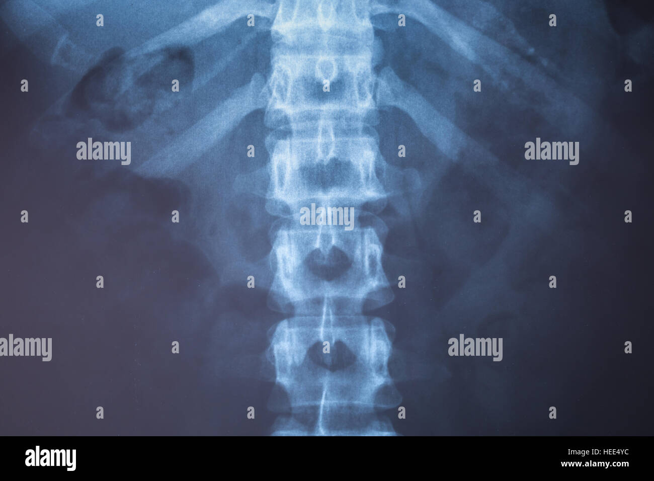 Xray hand normal hi-res stock photography and images - Alamy