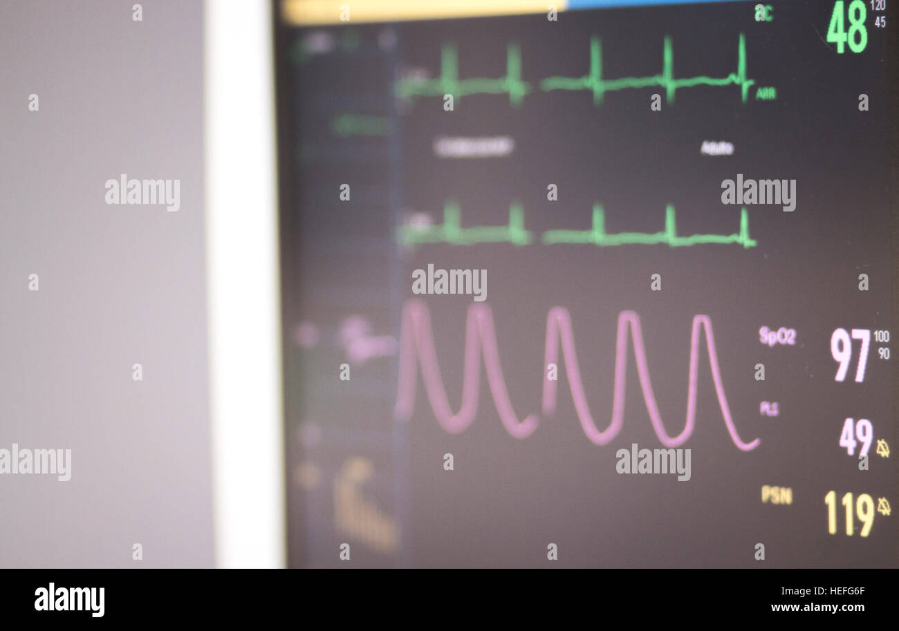 Electrocardiograph in hospital surgery operating theater emergency room ...