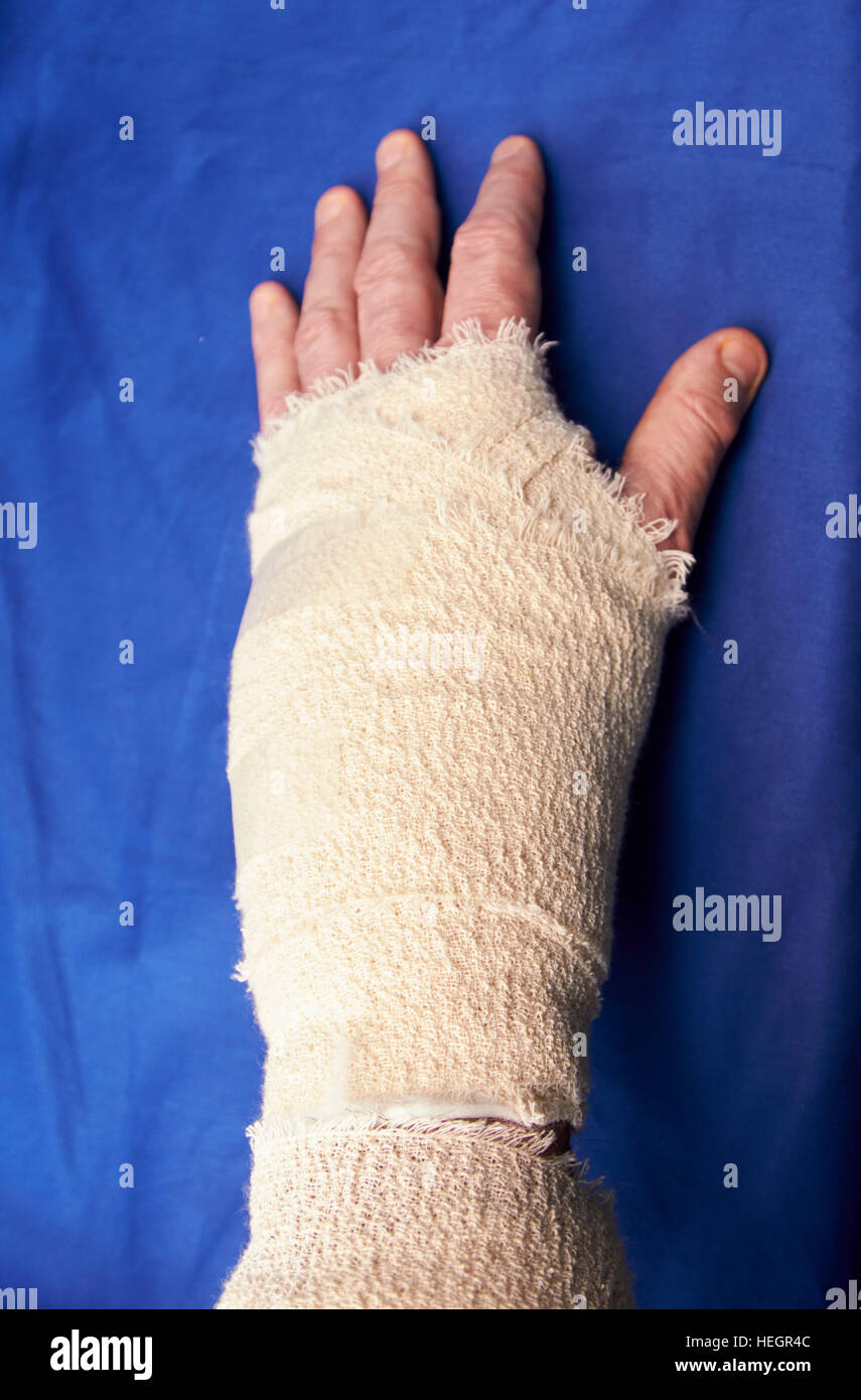 Bandaged Man Stock Photos & Bandaged Man Stock Images - Alamy