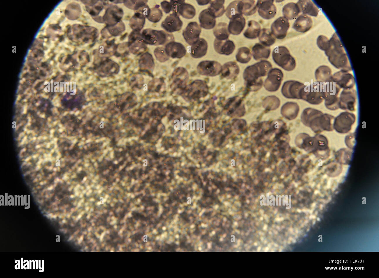 White blood cells observed under a microscope at the Troop Medical ...