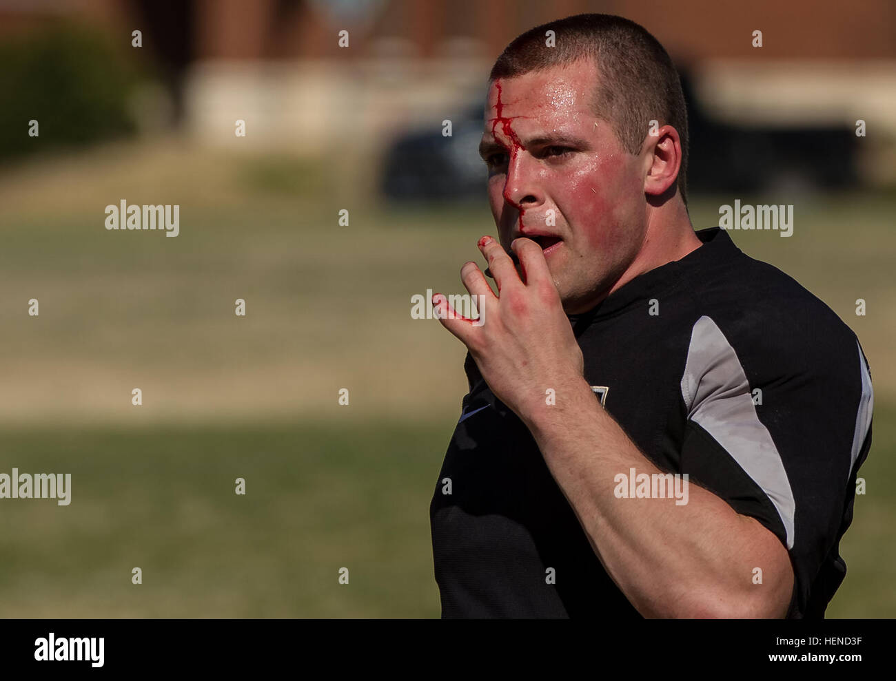 Bloody Forehead High Resolution Stock Photography and Images - Alamy